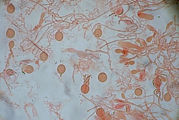 Exidia nucleata | SOCIEDAD MICOLÓGICA EXTREMEÑA